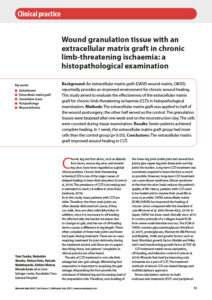 Wound granulation tissue with an extracellular matrix graft in chronic ...