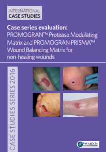 Case series evaluation: PROMOGRAN™ Protease Modulating Matrix and ...