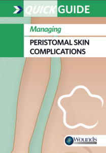 Managing peristomal skin complications Quick Guide – Wounds Asia