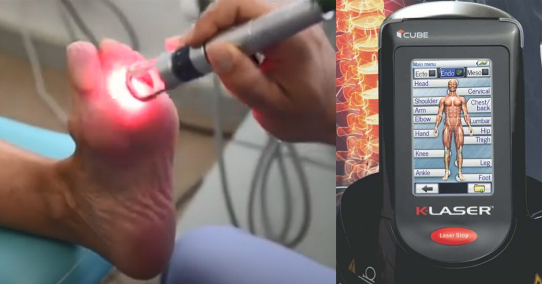 The use of photo biomodulation as an adjunct therapy to aid wound ...